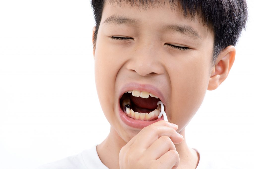 Greenville Dentist Helps Children Avoid Cavities | Smith Family Dentistry