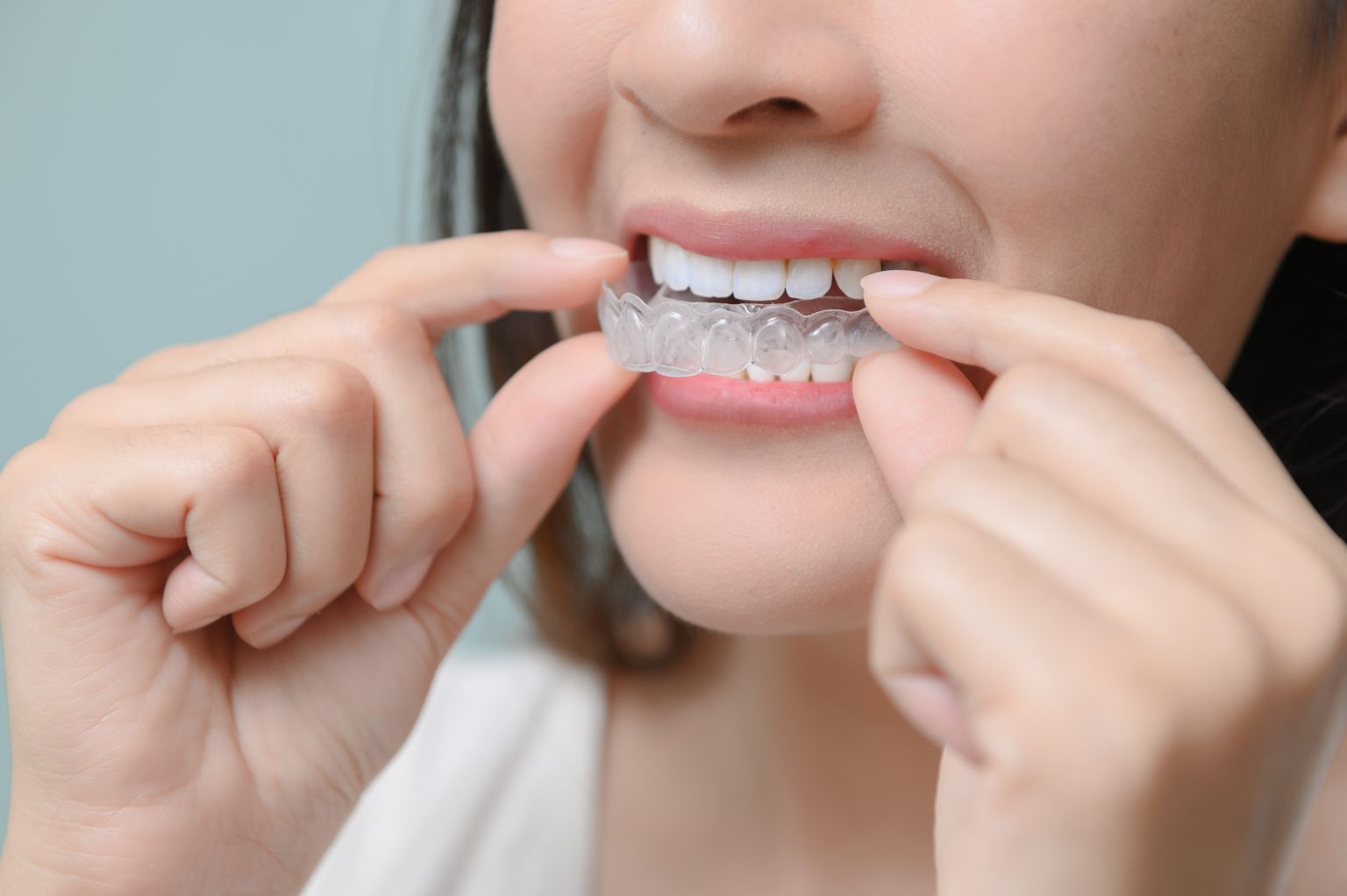 Greenville Dentist Offers A Better Smile With Invisalign®